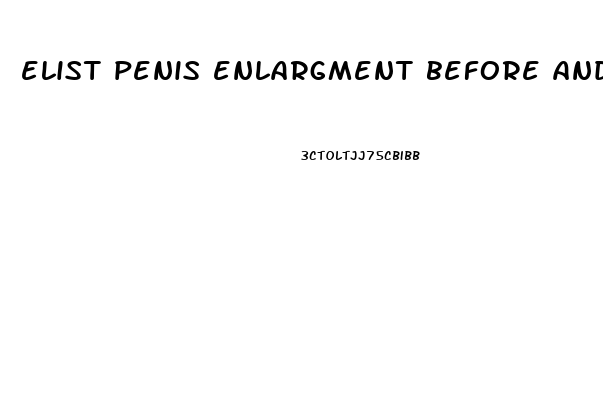 Elist Penis Enlargment Before And After Erection - How To Boost Low ...